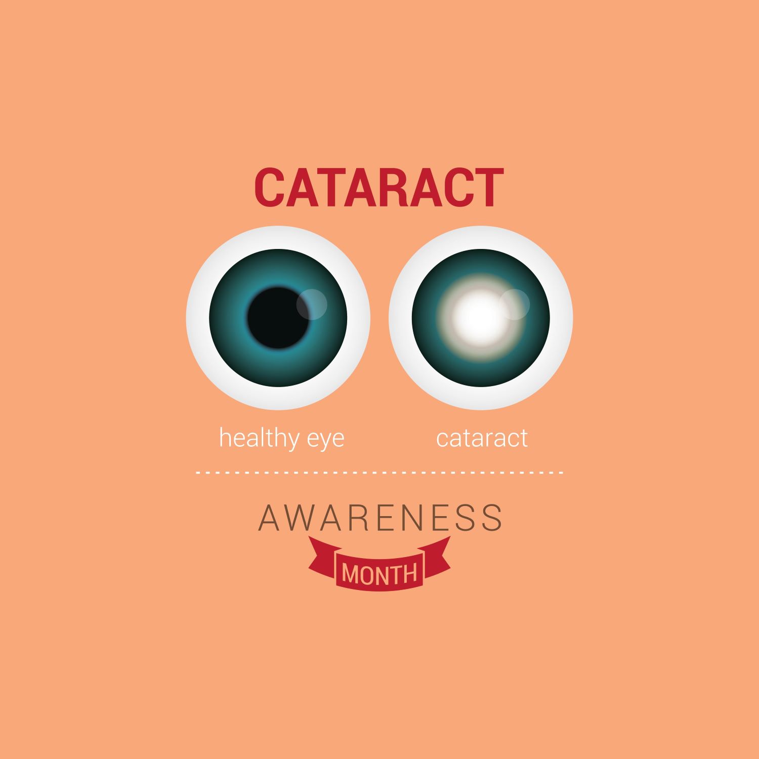 What You NEED To Know About Cataracts - Jennifer Loh MD